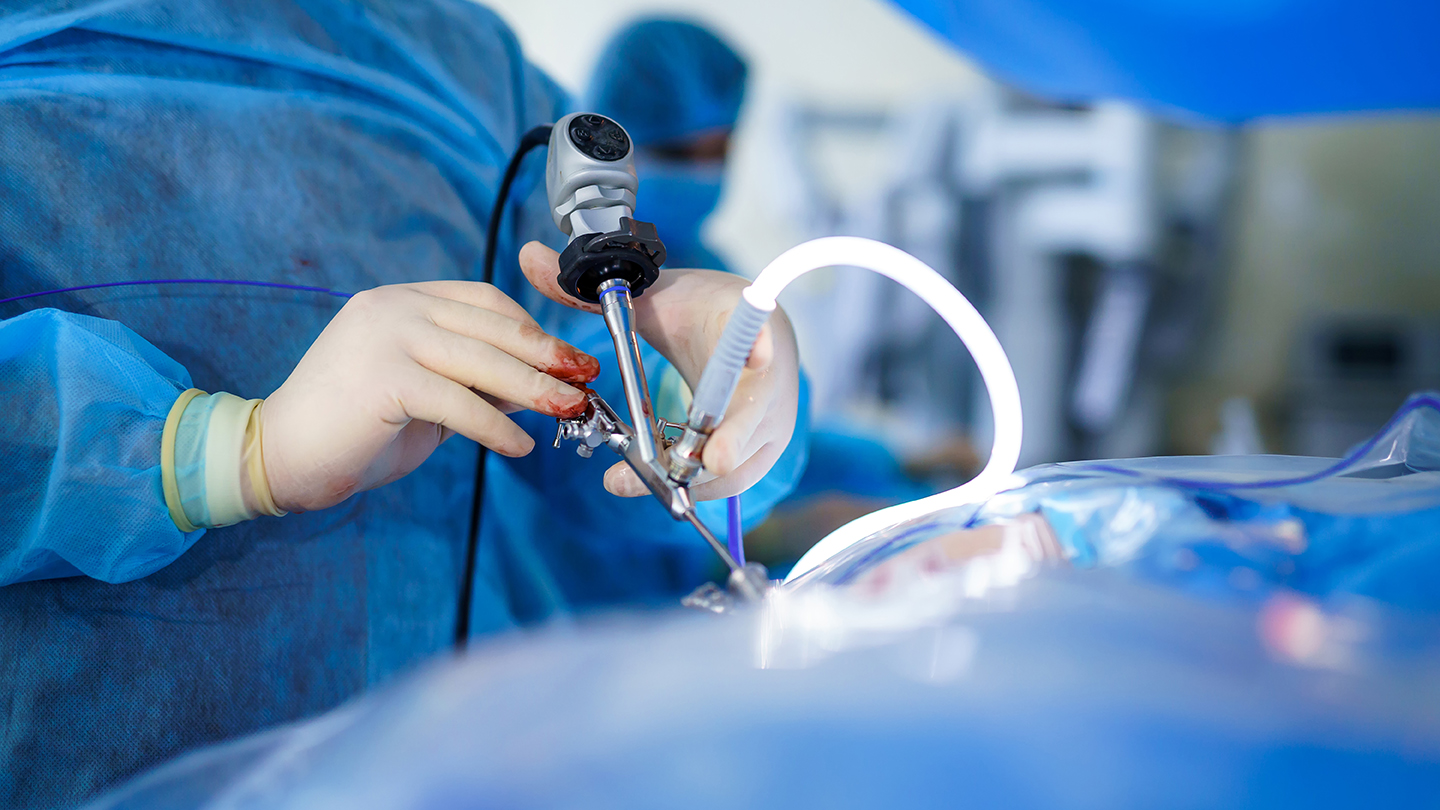 GI and Hepatology News - Surgical vs endoscopic excision of large colon ...