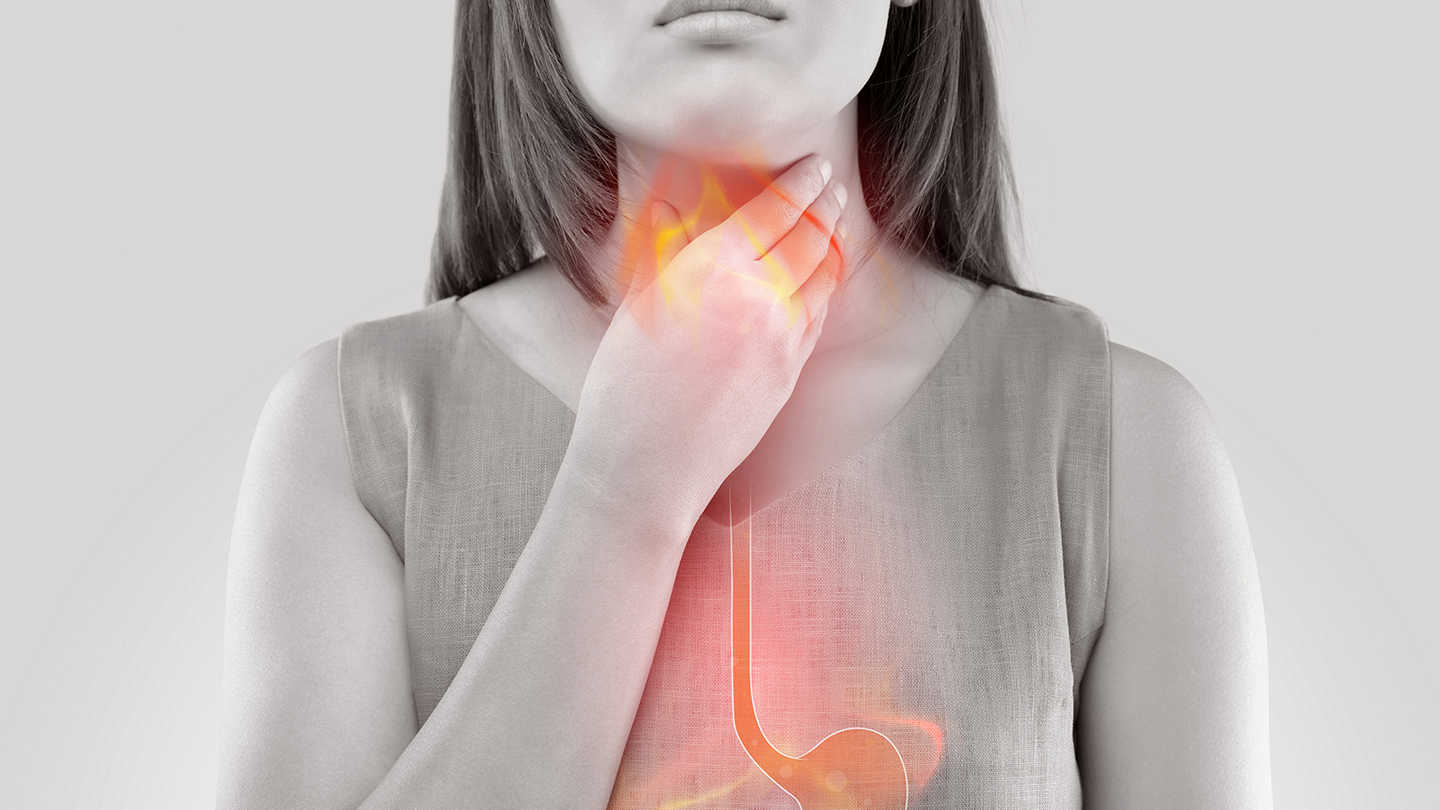 GI and Hepatology News - Sequential endoscopy may boost GERD control