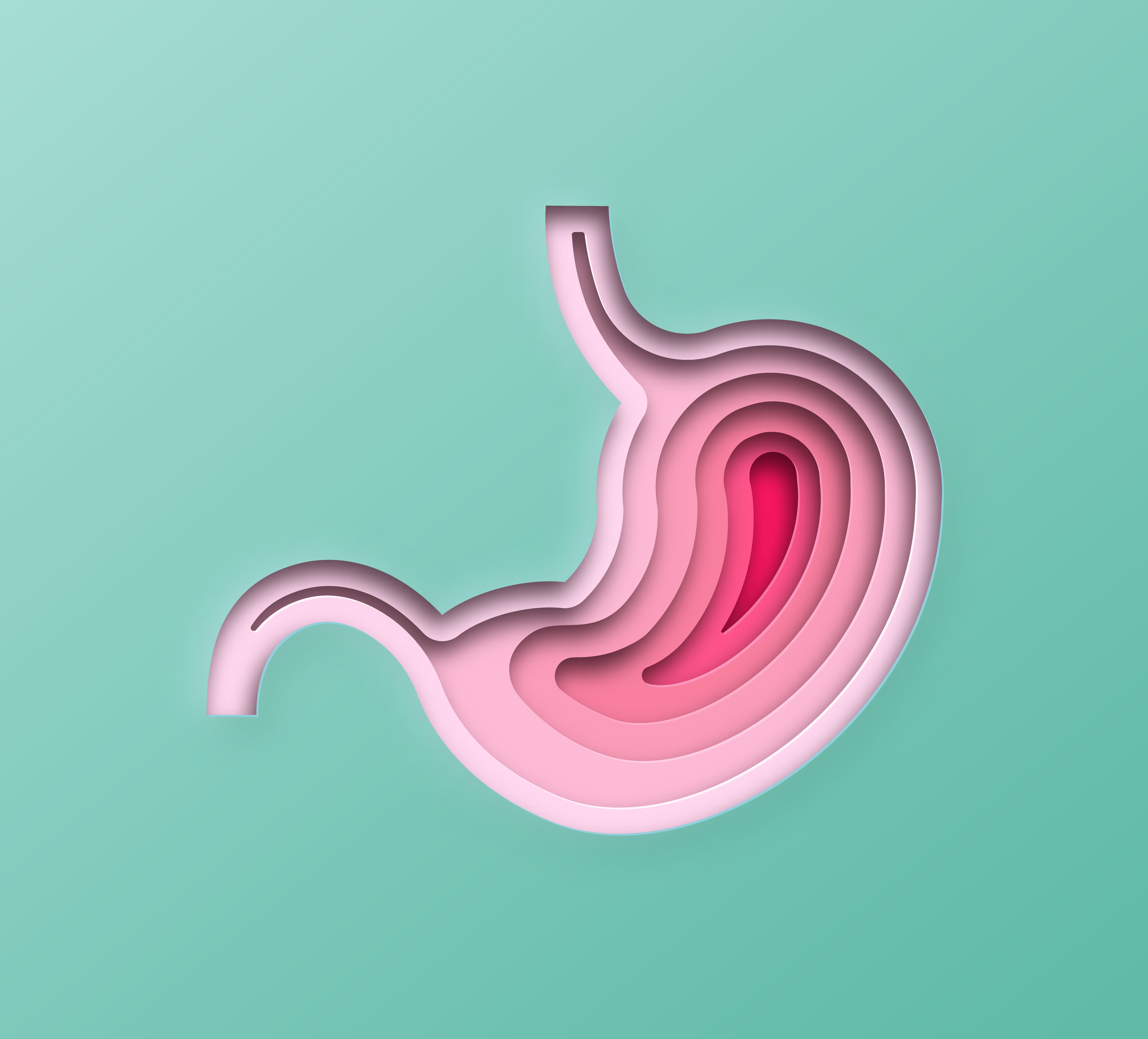 GI and Hepatology News - Exercise patterns and GI cancer risk