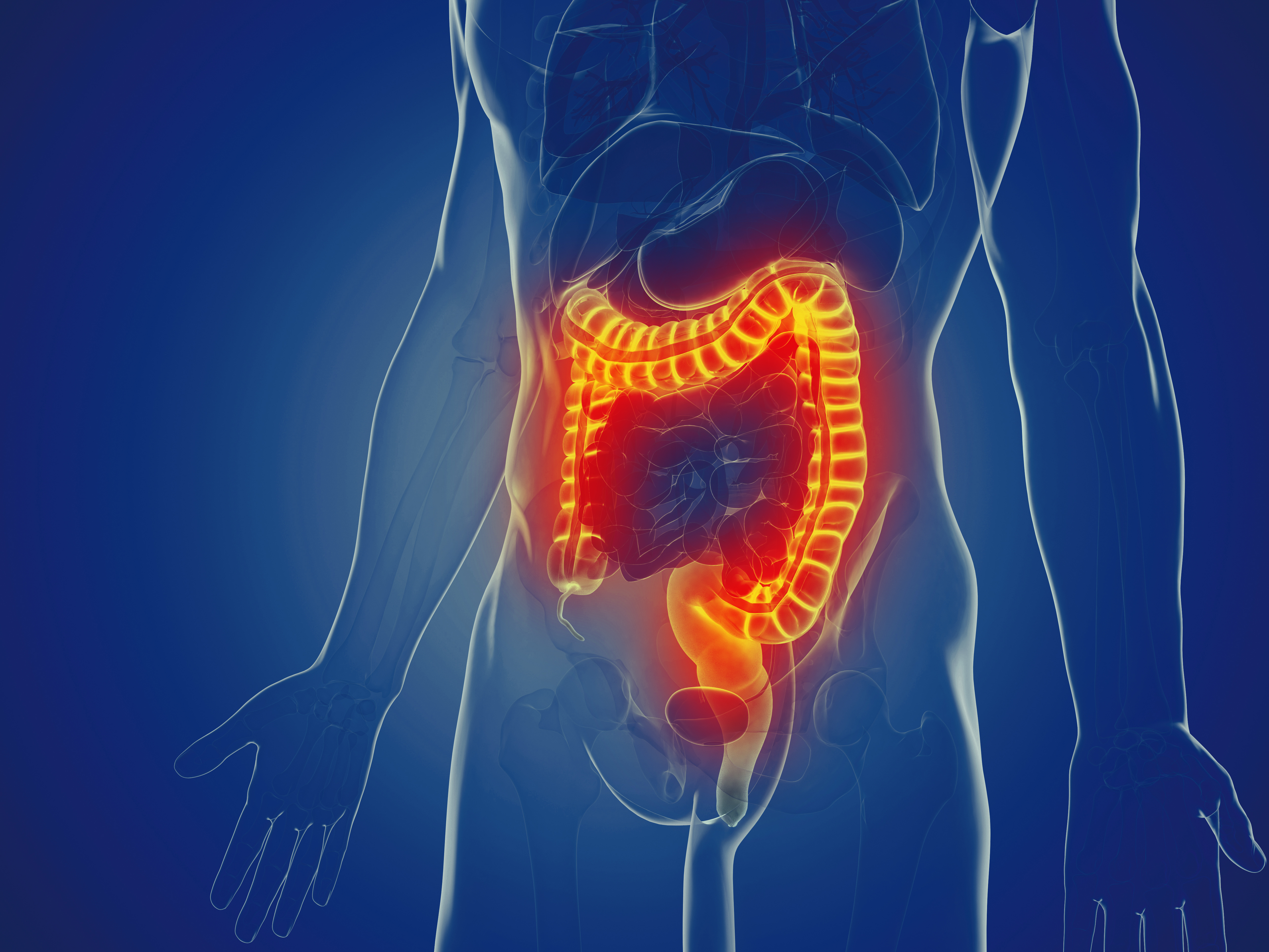 GI and Hepatology News - Mirikizumab shows promise for kids with ...